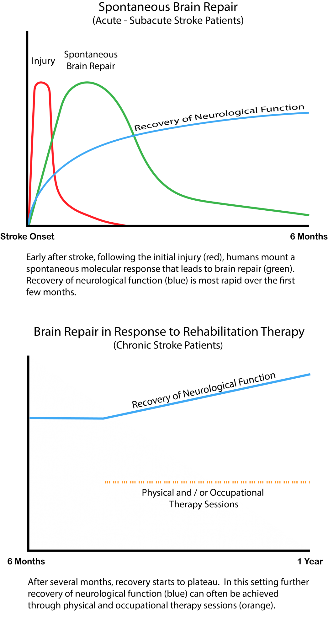 Biomarkers of Stroke Recovery Lab | Center for Brain Plasticity and ...